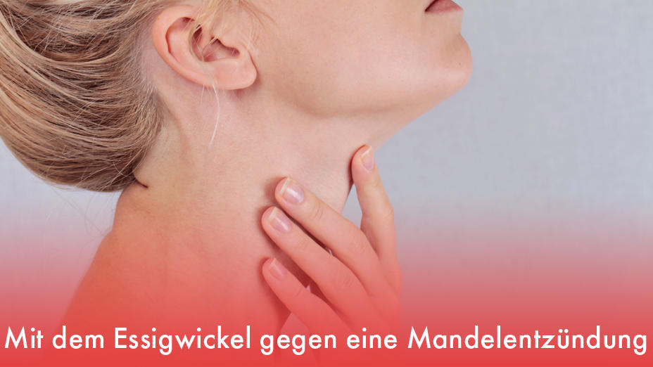 Gesundheitslexikon: Mandelentzündung (Angina tonsillaris)