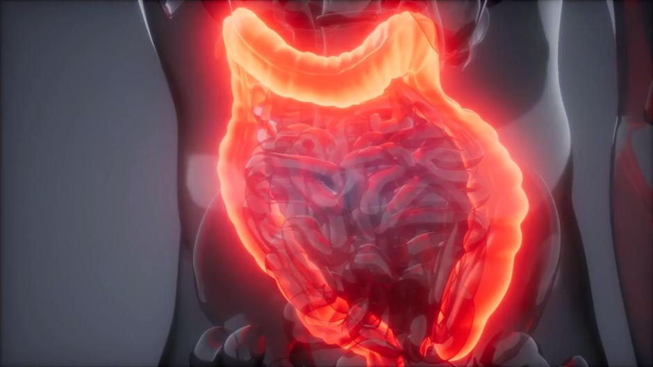 Gesundheitslexikon: Colon (Grimmdarm)