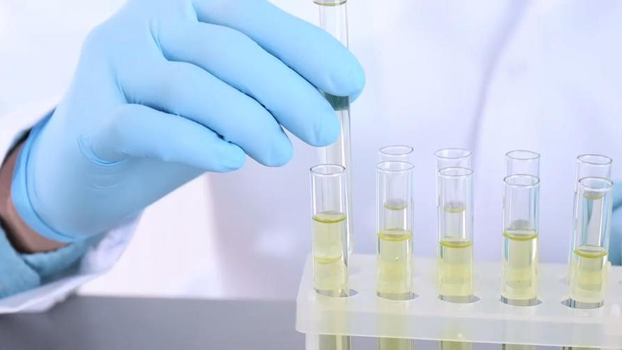 Gesundheitslexikon: Harnstoff