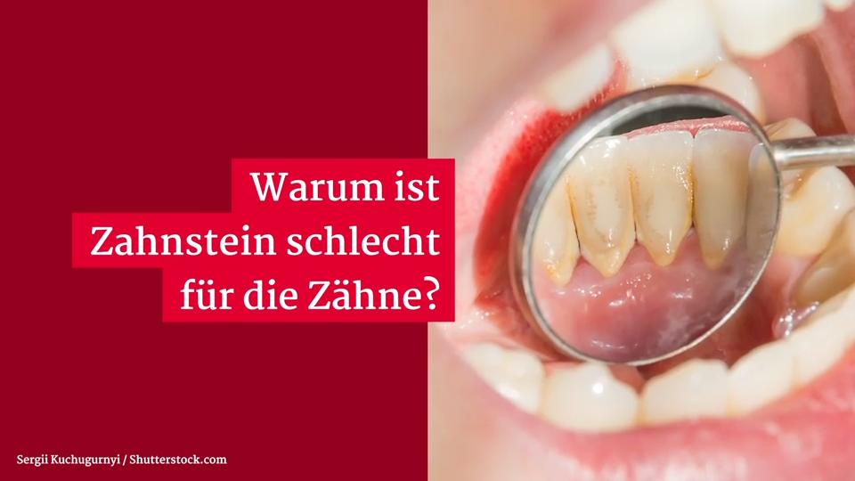 Gesundheitslexikon: Zahnstein