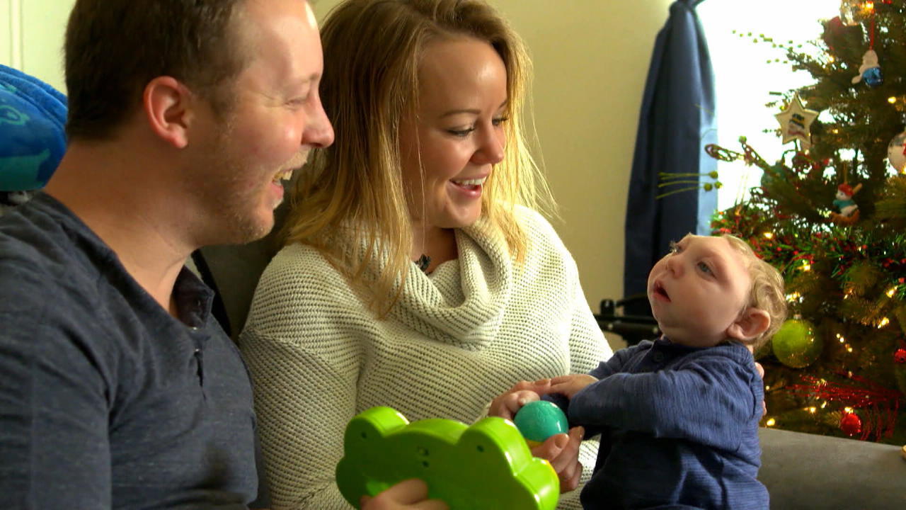 Wunderkind Jaxon Buell (†5) ist tot: Er lebte mit deformiertem Kopf