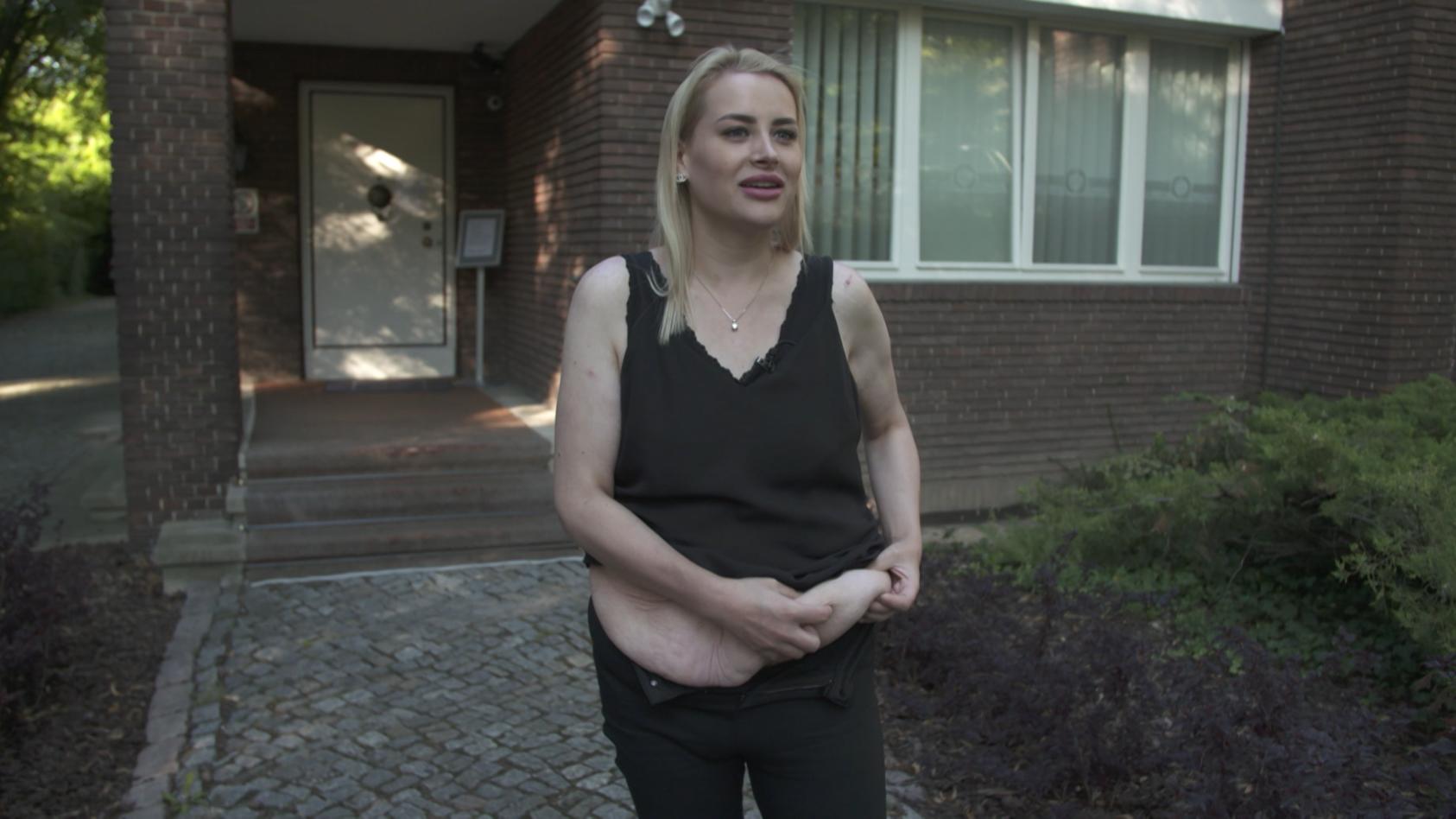 Ex-DSDS-Star Aline Bachmann hat 111 Kilo abgenommen: Jetzt sollen die ...