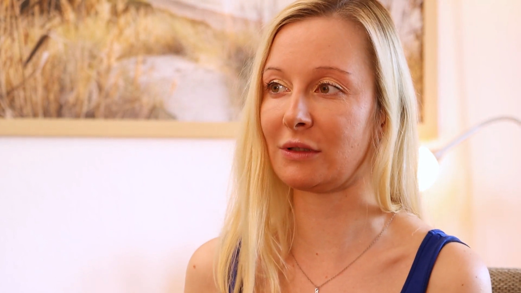 Wenn Duschen zur Qual wird: Frau (31) ist allergisch gegen Wasser