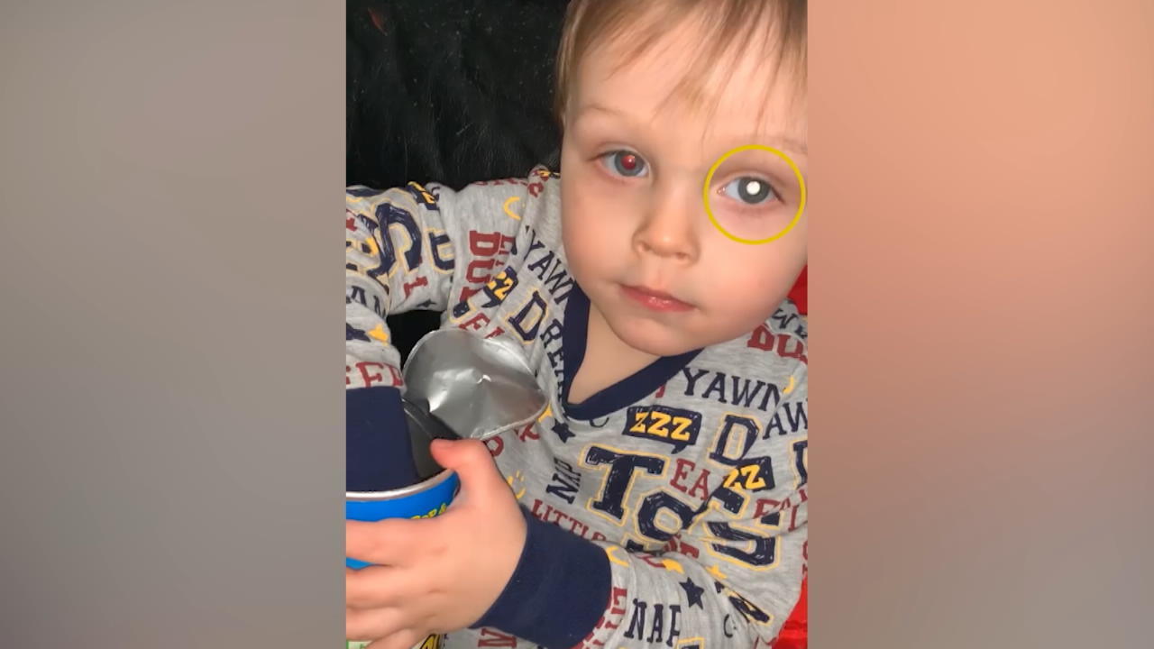 Videodetail enthüllt tödliche Wahrheit: Cayson-Jay (2) hat Krebs