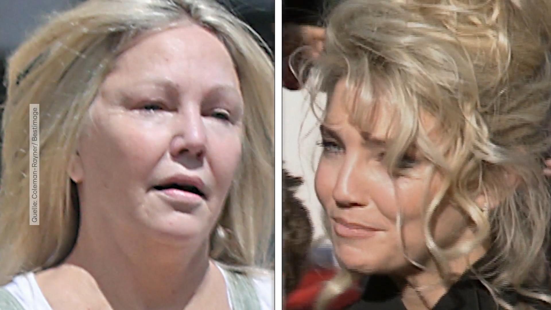 Heather Locklear, was ist mit dir passiert? Fans in großer Sorge um ...