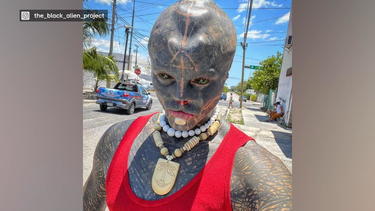 Anthony Loffredo auf dem Weg zum "Black Alien": Dieses Körperteil soll ...