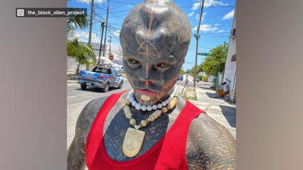 Anthony Loffredo auf dem Weg zum "Black Alien": Dieses Körperteil soll ...