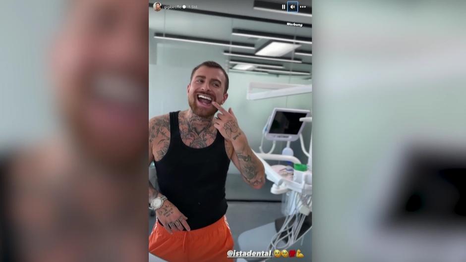 Ex-Dschungelcamp-Kandidat Gigi Birofio: Endlich ist sein Gebiss wieder komplett!