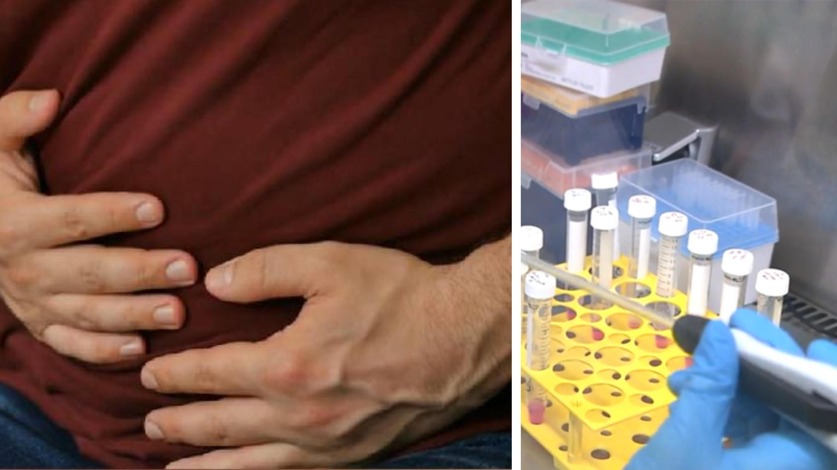 Patienten vertauscht! Falschem Mann wird Magen entfernt