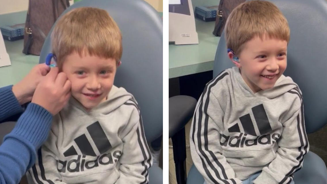 Endlich ein Hörgerät! Kleiner Junge hört zum ersten Mal die Stimme ...