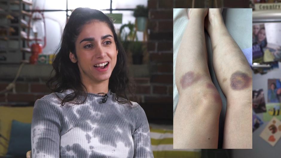 AWZ: Autsch! Dieser Dreh brachte Suri Abbassi dicke blaue Flecken ein