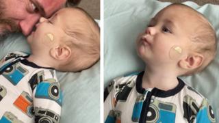 Ärzte gaben ihm kaum Überlebenschancen! Mit DIESEM Moment trotzt Baby ...